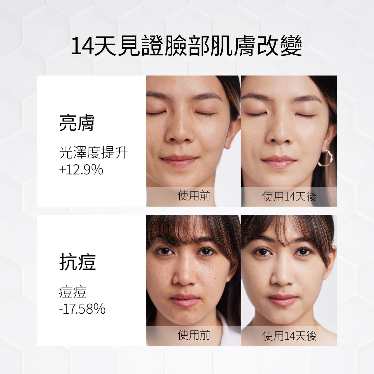 Ulike 白皇后LED美容面膜儀-限時團購